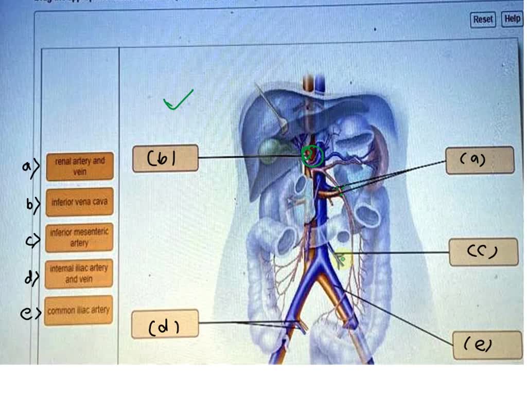 VIDEO solution: Lab 5 SECTION 6: Major Vessels of the Thorax, Abdomen, and Pelvis A. Label ...