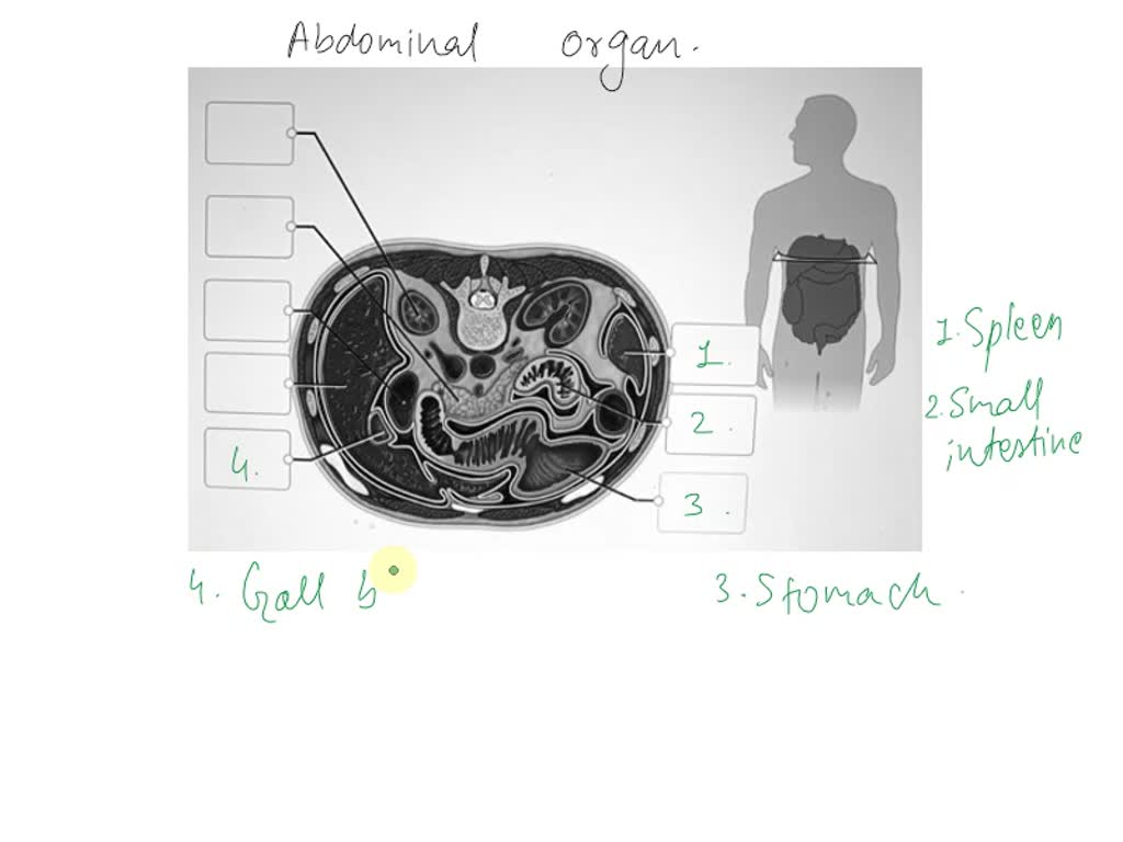 SOLVED: Label the various abdominal organs in the transverse section provided Lung Kidney ...