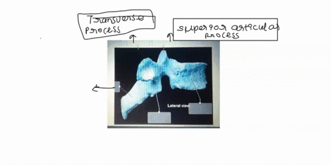 label the structures of a typical vertebra labels drop zones reset all ...