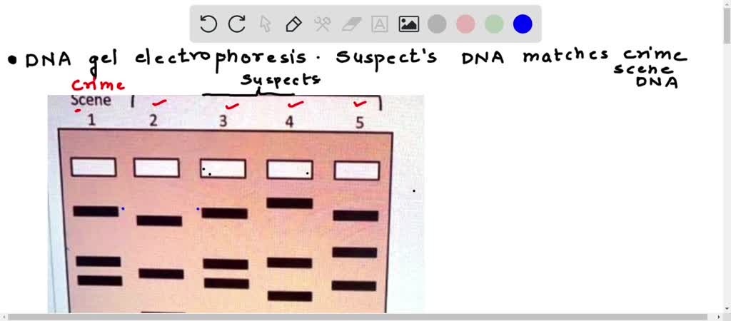 SOLVED: Use the DNA gel electrophoresis results shown below to answer ...