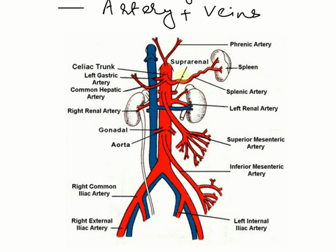 Art-labeling Activity: Figure 19.23b (1 of 4) Brachiocephalic trunk ...