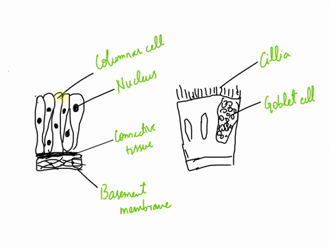 Label the parts of the cross-section shown. Hayden-McNail, LLC Lumen of ...