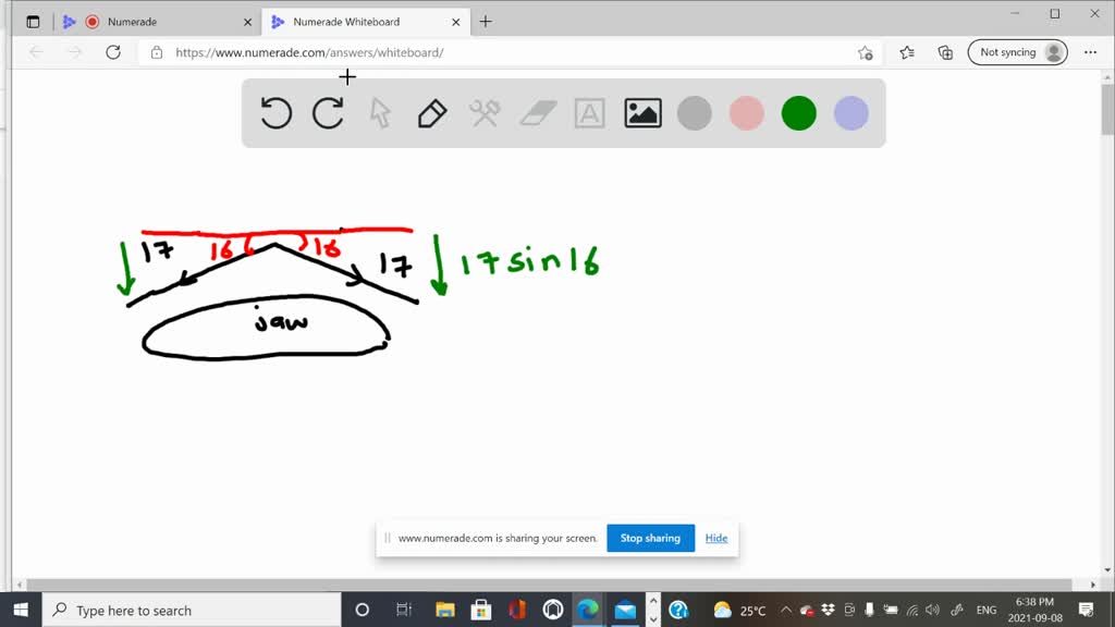 SOLVED: The drawing shows a wire tooth brace used by orthodontists. The ...