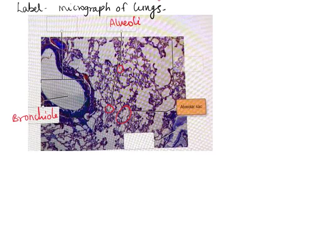 SOLVED: Label the human lung tissue by clicking and dragging the labels ...
