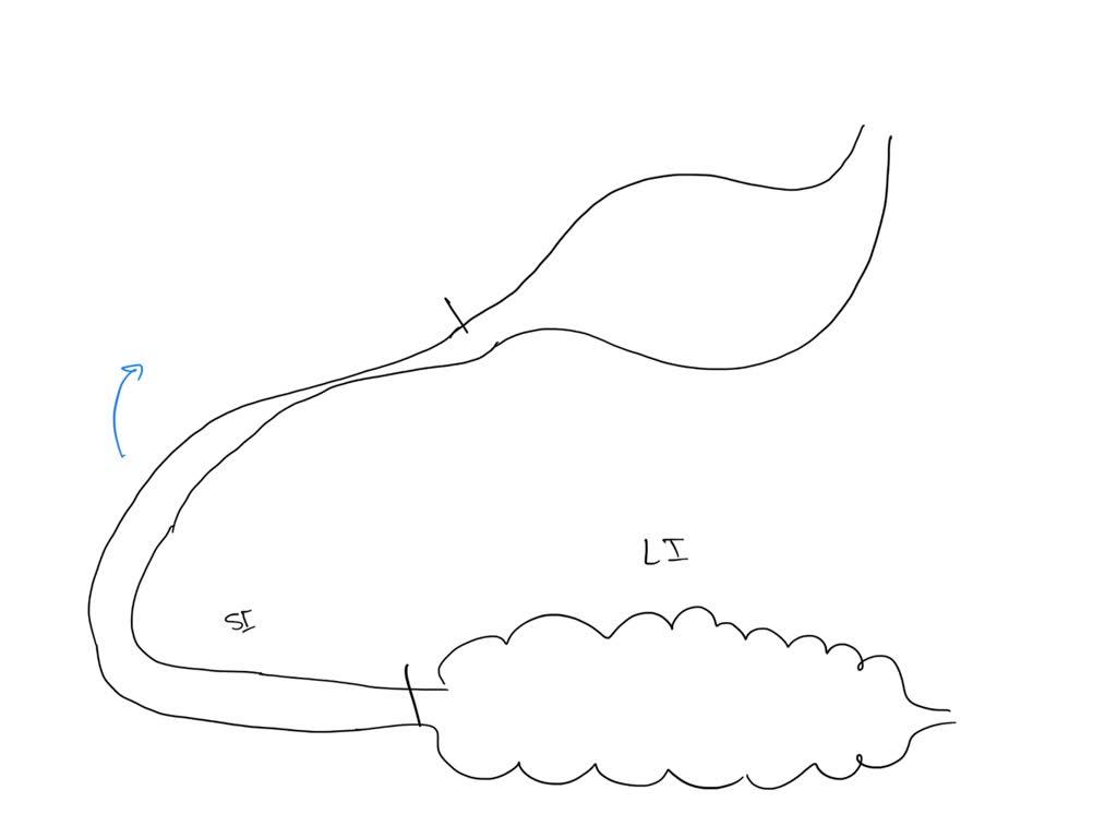 SOLVED: 24. What is the major means of chyme, urine, and ova propulsion ...