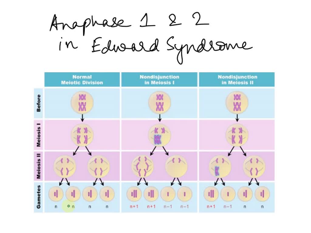 SOLVED: A child with Edwards Syndrome has the karyotype shown. Children ...