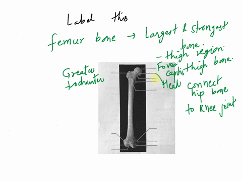 14. Match the bone names and markings in the key with the...
