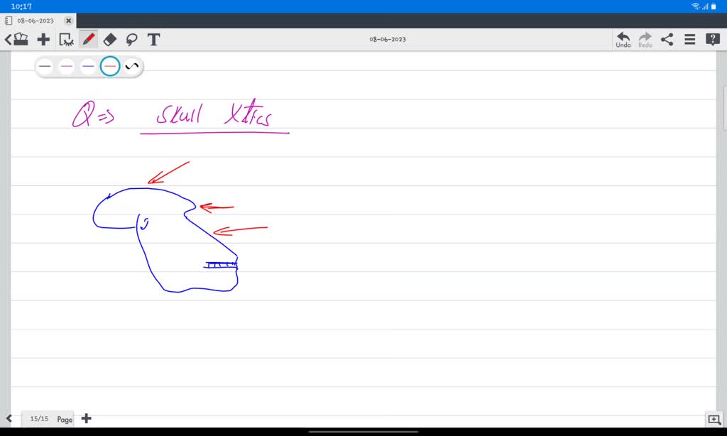 SOLVED: You are shown a hominid skull with a very large brain but a ...