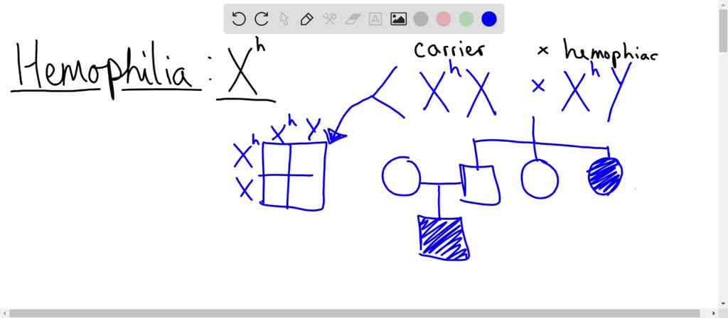 Solved A Recessive Sex Linked Gene H Located On The X Chromosome