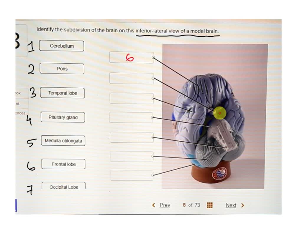 SOLVED: Identify the structures on this posterior-lateral view of a ...