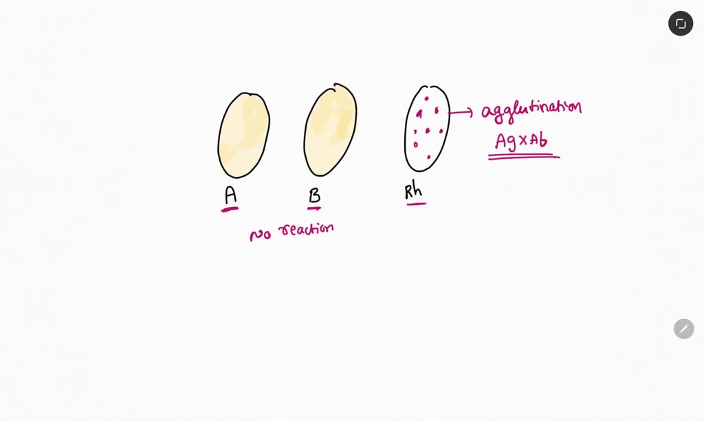 SOLVED: Name the indicated blood type shown below. The dots represent ...