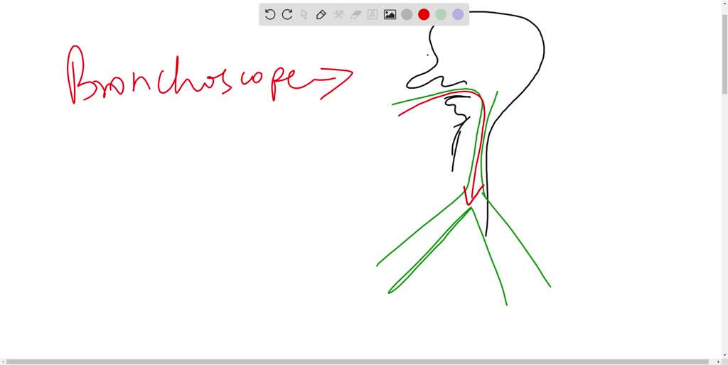 SOLVED: describe the 'Direct Smear Method' of faecal sample examination ...