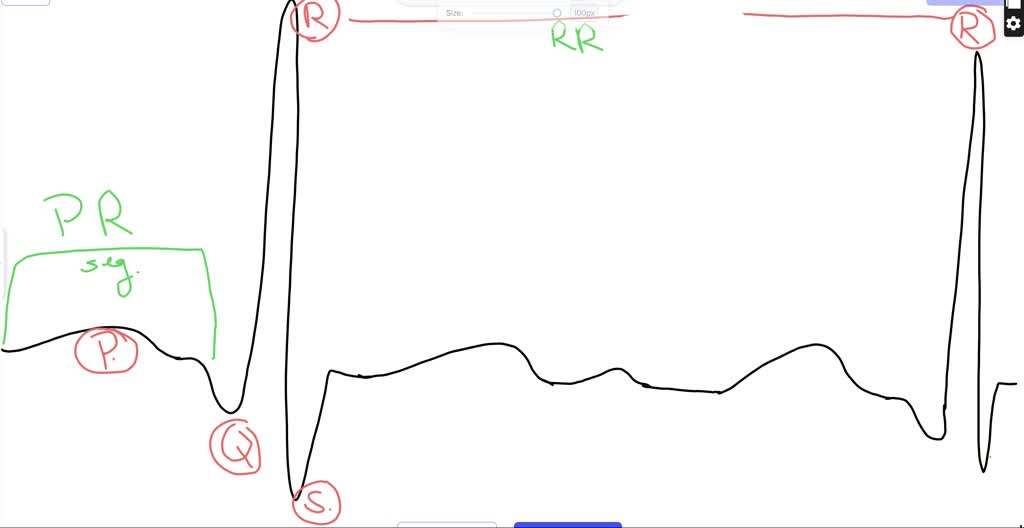 SOLVED: Cardiovascular Physiology PRE-LAB ACTIVITY The following ...