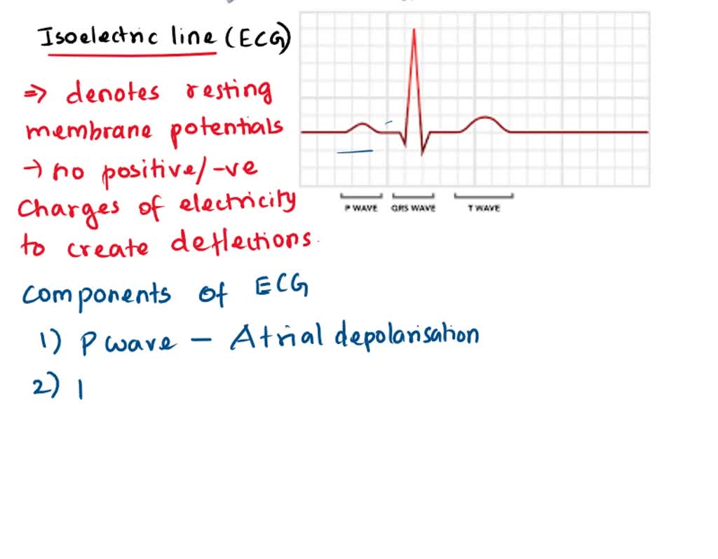 What is the isoelectric line of the ECG? Which components of the ECG ...