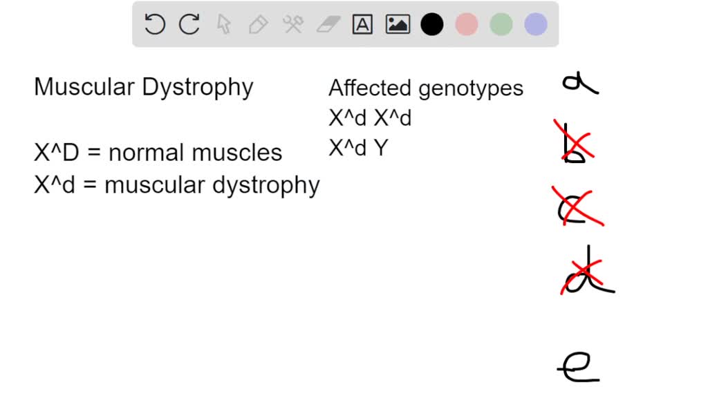 SOLVED: Duchenne’s muscular dystrophy is an X-linked recessive disorder ...