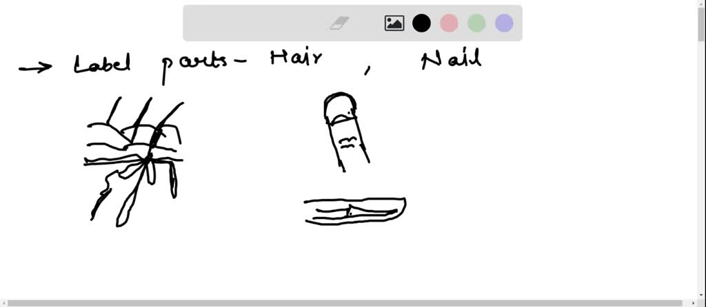 SOLVED: Nail Abnormalities Select the abnormal findings that an ...