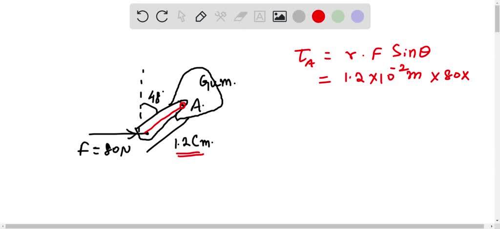 SOLVED: A dental bracket exerts a horizontal force of 80.0 N on a tooth ...