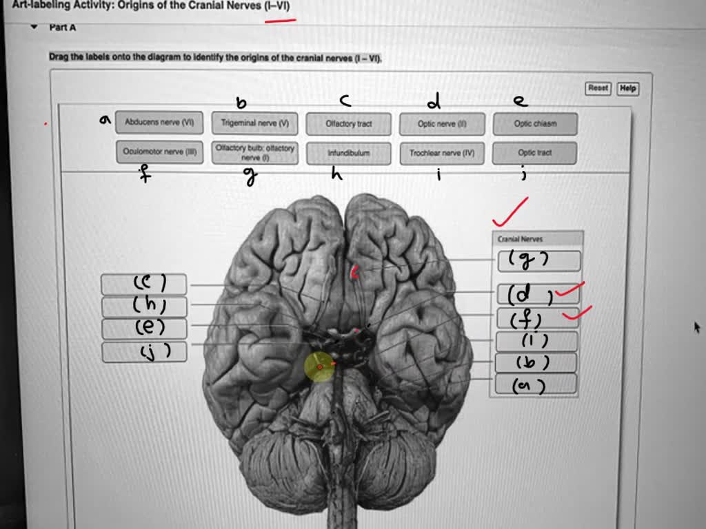 SOLVED: Art-labeling Activity: Origins of the Cranial Nerves (I-VI ... SOLVED: Art-labeling Activity: Origins of the Cranial Nerves (I-VI ...