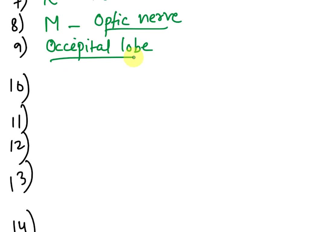 SOLVED: Eye Dissection Review and Labeling NAME: Answer the following ...