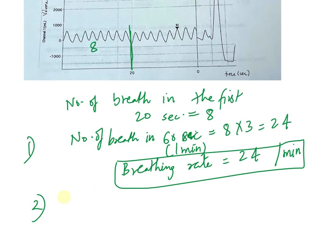 SOLVED: The image below is a typical spirogram, where the red signal shows airflow and the blue ...