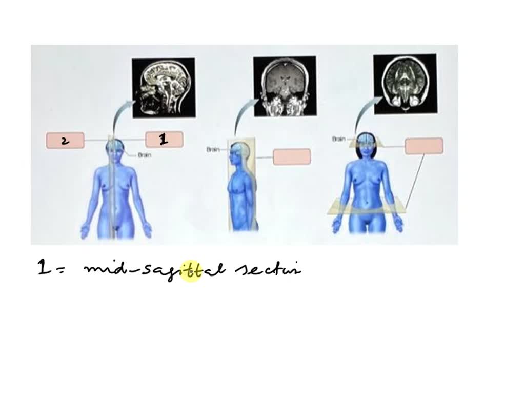 SOLVED: Art-Labeling Activity: Planes of Section The Language of ...