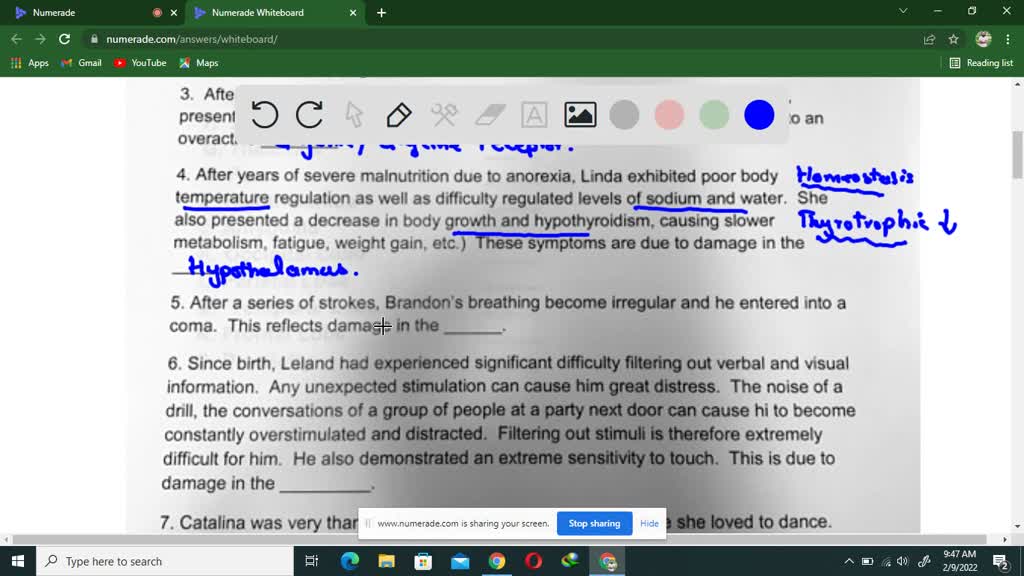 SOLVED: Anatomy of the Nervous System Human Dovelopment for Nursing ...