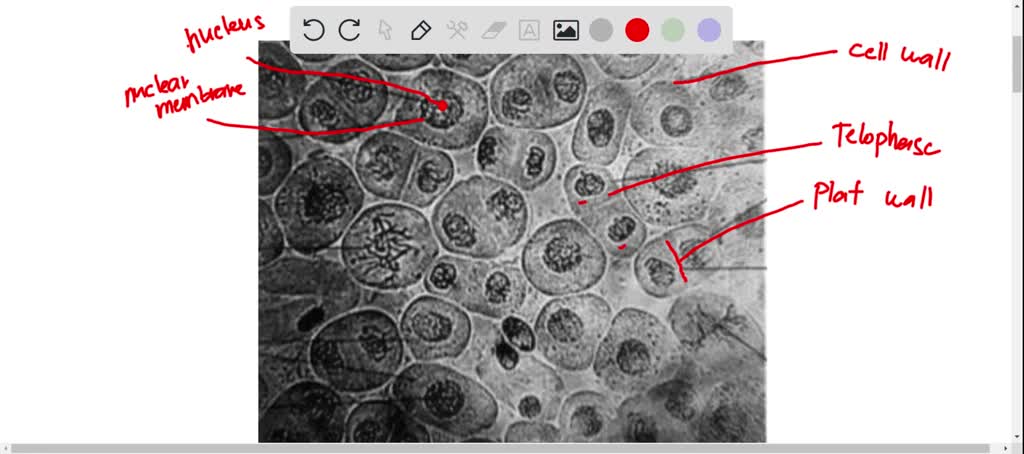 SOLVED: Label your picture clearly, including the following: chromatids ...