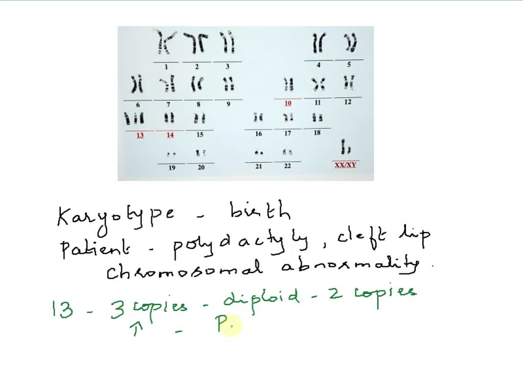 SOLVED: Patient C's Karyotype T0 10 12 13 14 15 17 18 19 20 22 XX KXY 3 ...