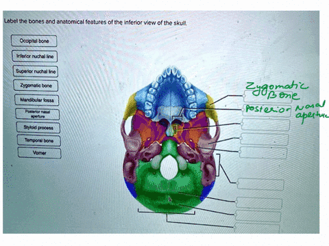 parts of the axis label the structures of the axis superior articular ...
