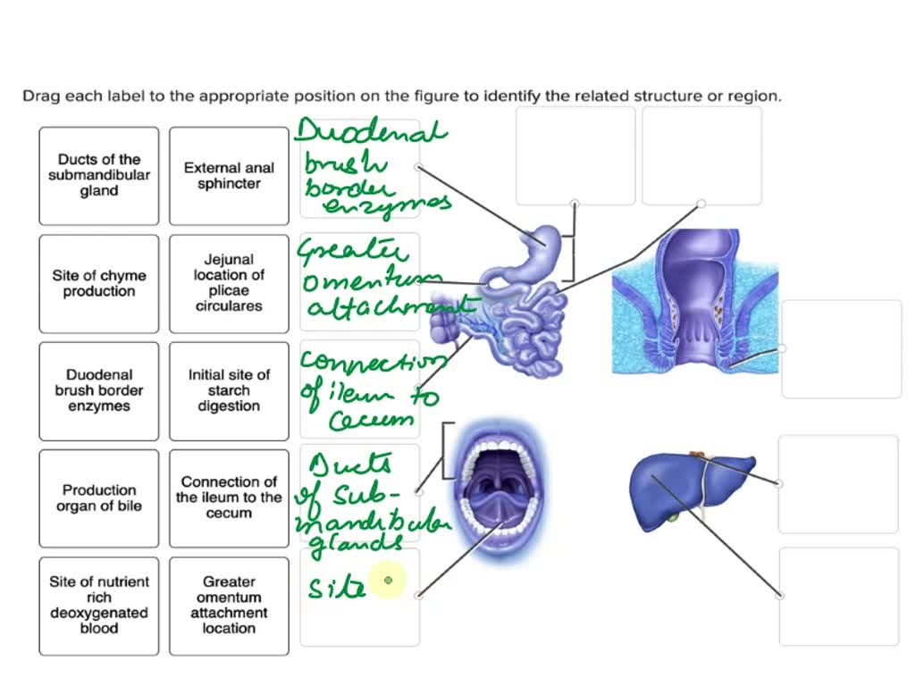 SOLVED: Texts: Art-labeling Activity: Arteries supplying the ...