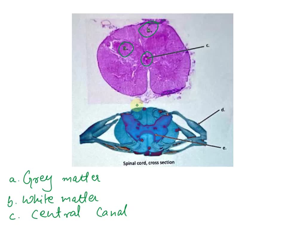 SOLVED: Label the following structures on the spinal cord: a. Gray ... SOLVED: Label the following structures on the spinal cord: a. Gray ...