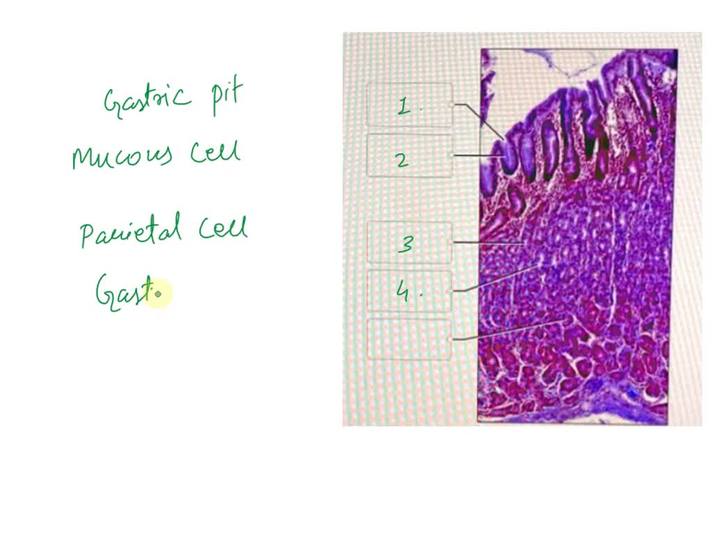 SOLVED: Light Micrograph of the Stomach Lining In the light micrograph of the stomach, label the ...