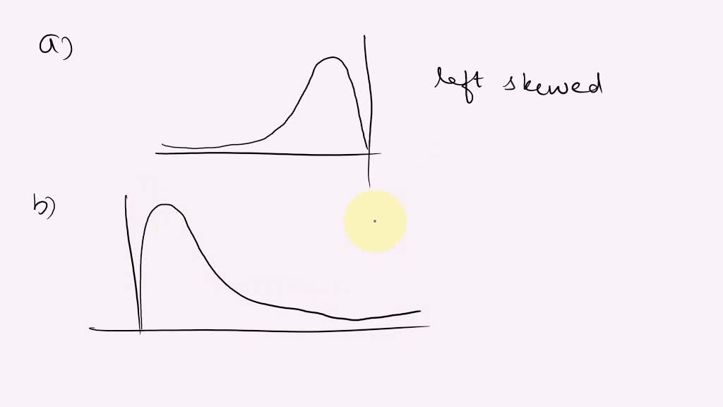 Solved Distribution Shapes Determine The Shape Of Each Distribution