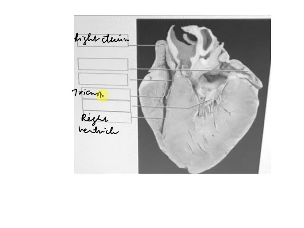 Right Ventricle (opened) Label the image below using drag and drop text ...