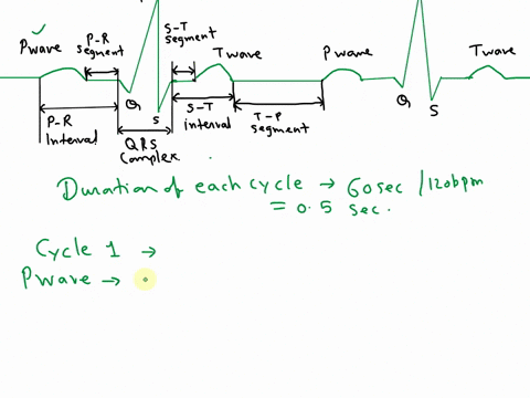 Let review the electrical events that occur during heartbeat...
