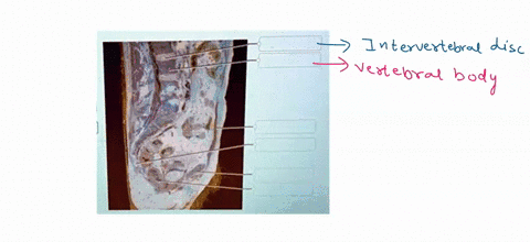 Identify Organs in a Cadaveric Transverse Section Through Pelvis Label ...