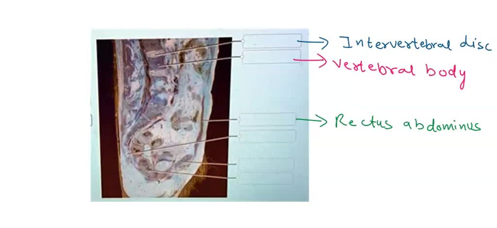 SOLVED: Identify Organs in a Cadaveric Transverse Section Through ...