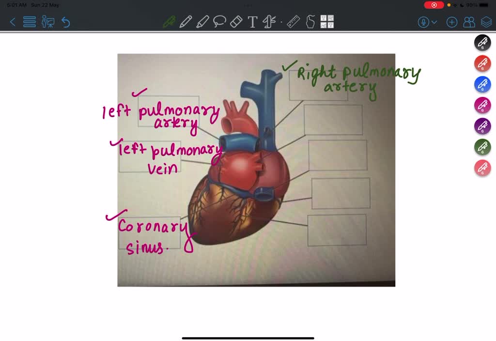 SOLVED: cerebral aqueduct third ventiicle interventricular foramen ...