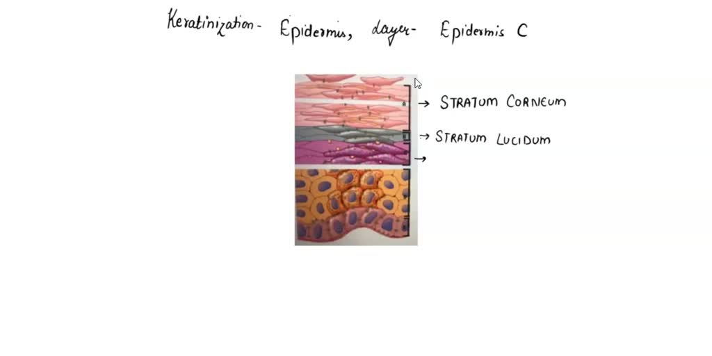 SOLVED: The figure illustrates the layers of the epidermis. Which layer ... SOLVED: The figure illustrates the layers of the epidermis. Which layer ...