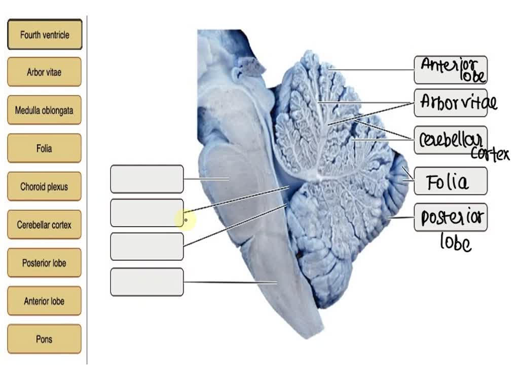 SOLVED: Label Subdural space, third ventricle, fourth ventricle ...