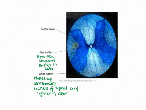 B. Identification of Spinal Cord Structures Label the spinal...