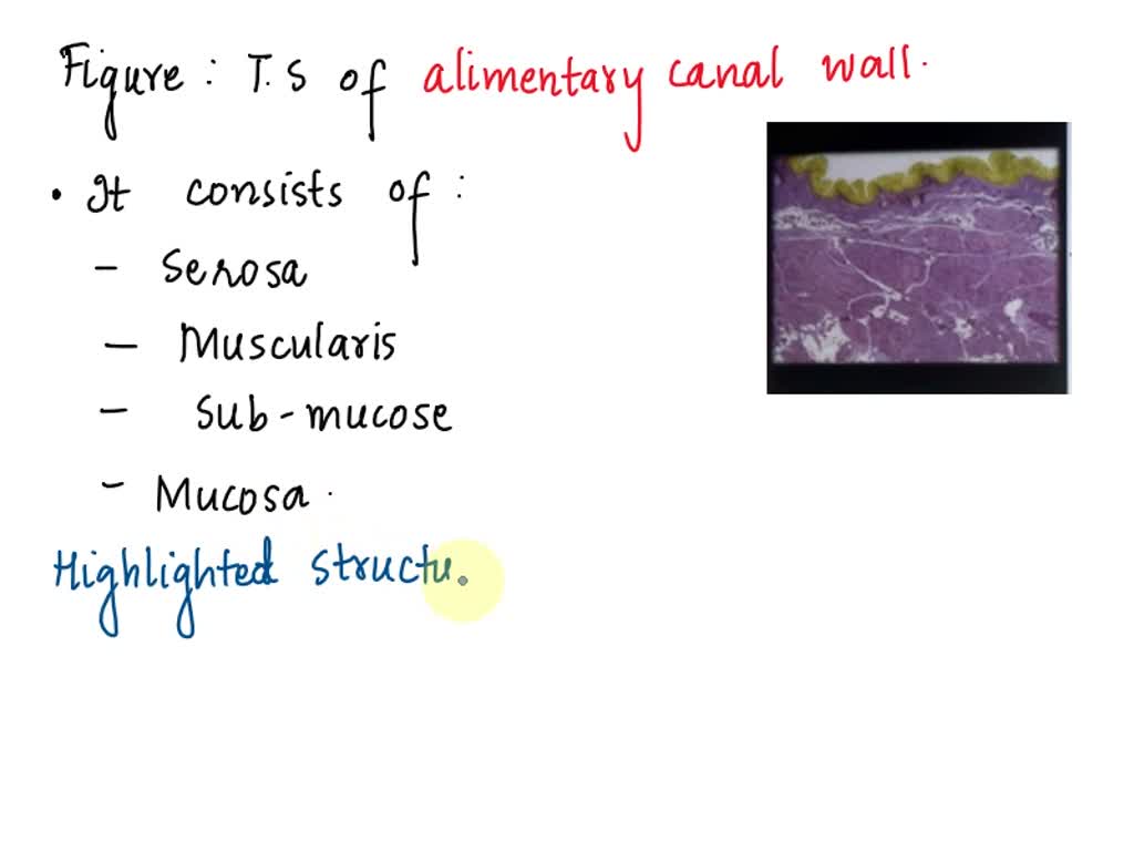 SOLVED: Which structure is highlighted? Multiple Choice O detrusor ...