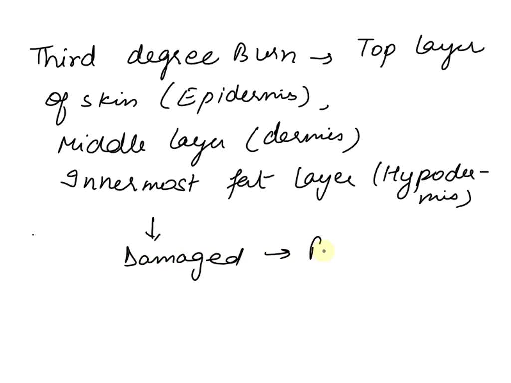 Solved Why Is A Third Degree Burn Immediately Life Threatening Loss Of Sensory Neurons
