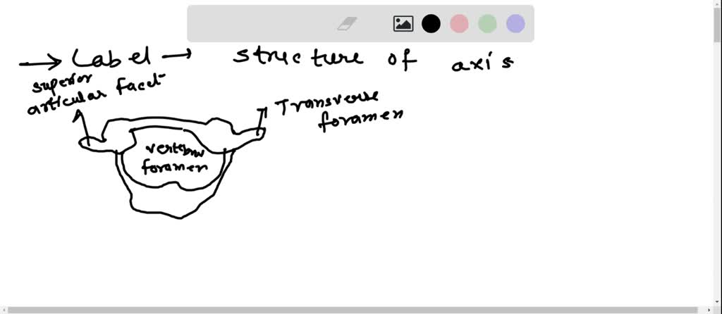 SOLVED: Pictures of the atlas. Transverse foramen. Transverse process ...
