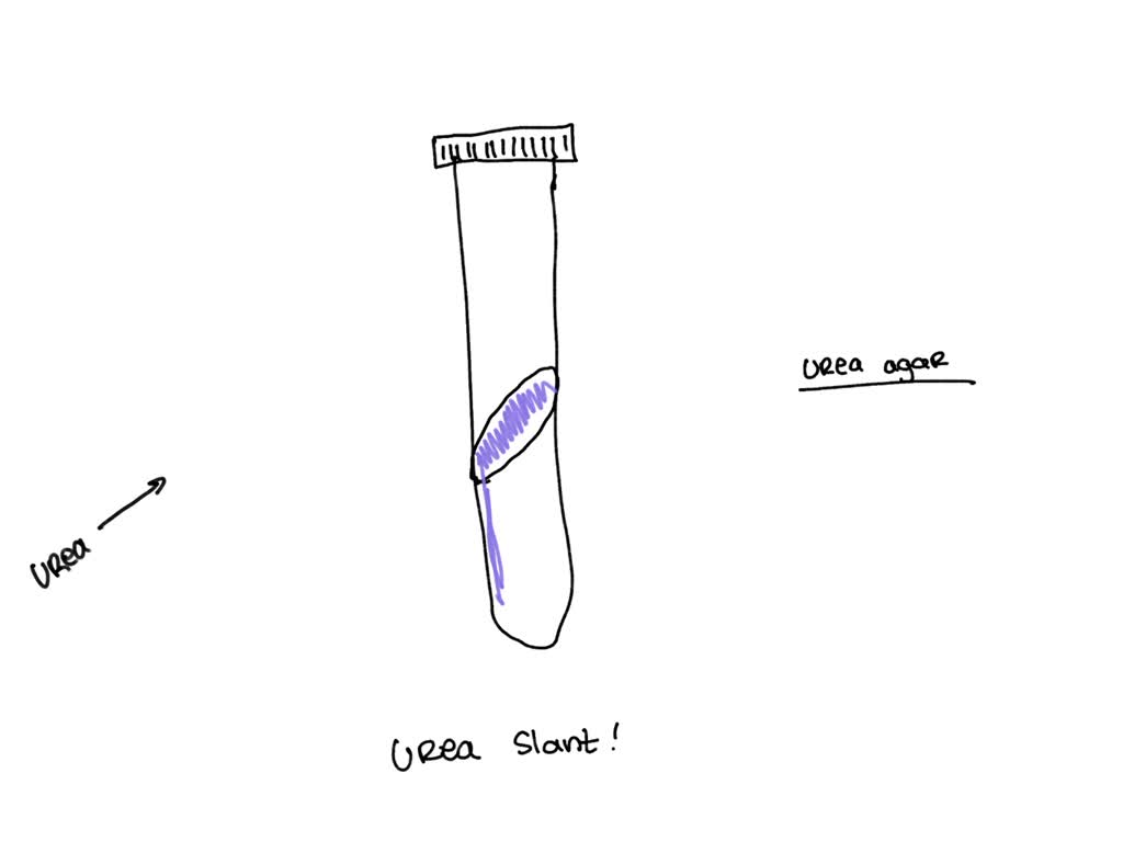 SOLVED: When using Urea Agar, what indicates a positive reaction? What ...