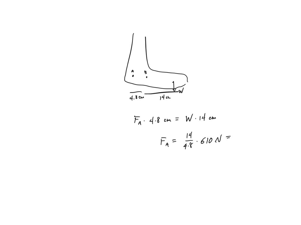 The figure shows the anatomical structures in the lower leg and foot ...