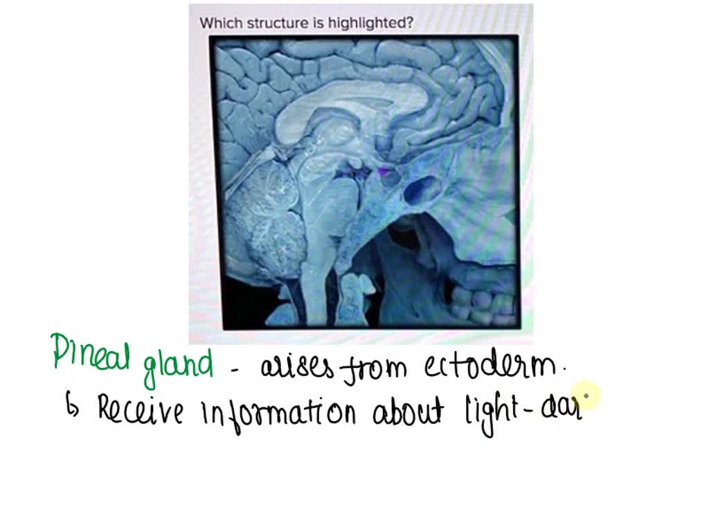 SOLVED: Which structure is highlighted? neurohypophysis, infundibulum ...