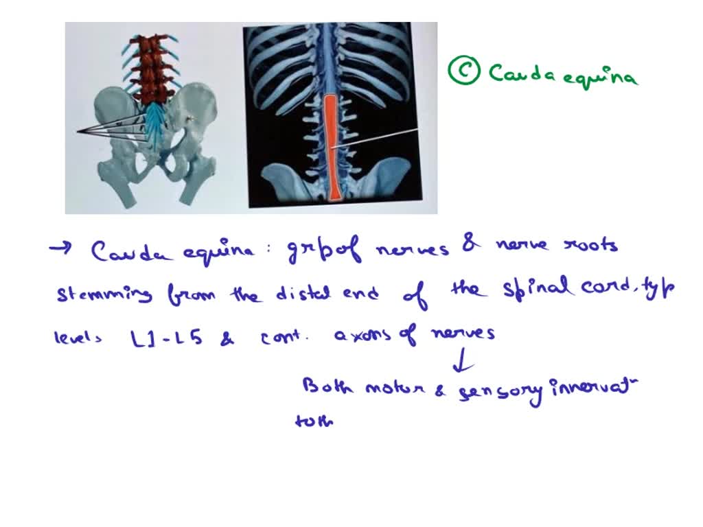 SOLVED: Which spinal nerve branches are highlighted (reference leader ...