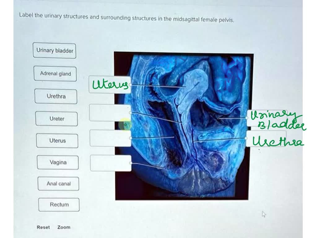 Solved Label The Structures Of The Pelvis Obturator Membrane Male Female Subpubic