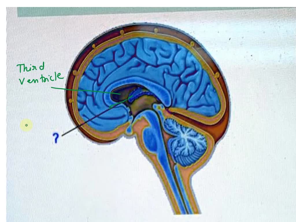 SOLVED: What is the function of the labeled structure? O allows CSF to ...